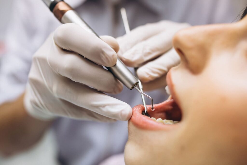 Perda de massa óssea dental: o que é e como acontece